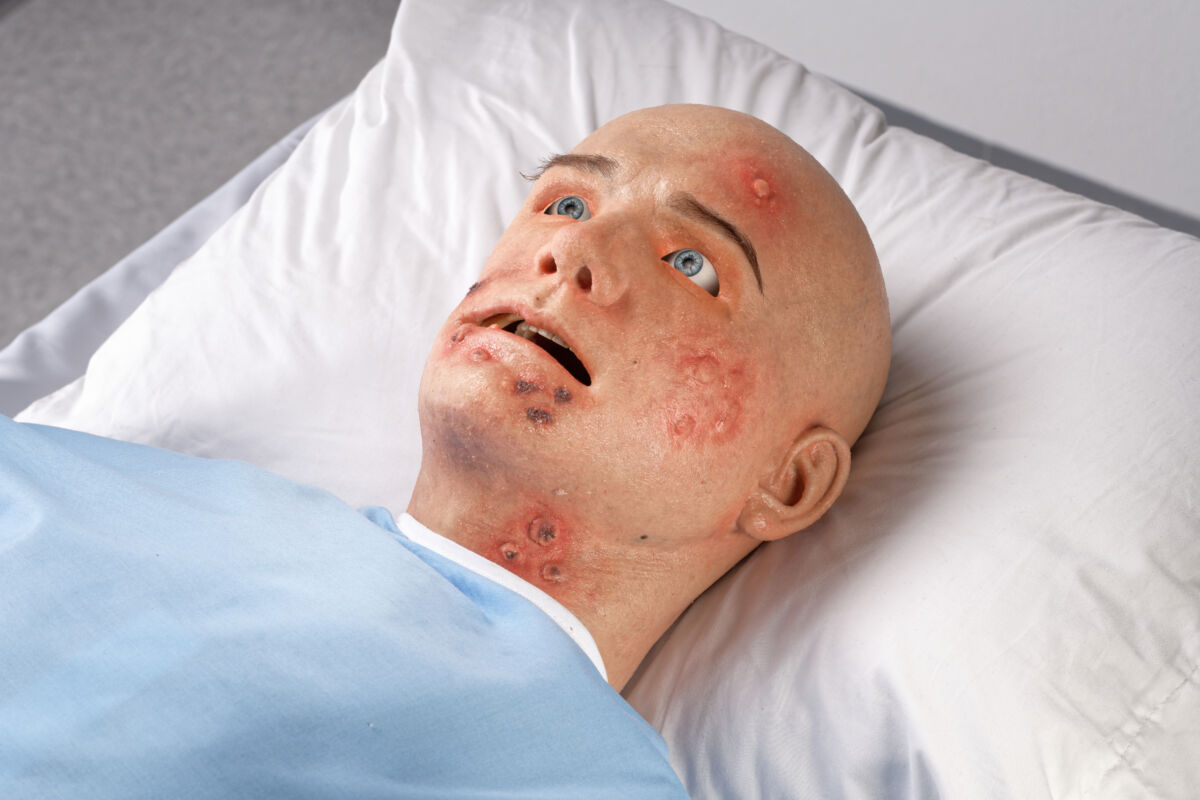 EchoMask by Echo Healthcare - Highly realistic simulation masks