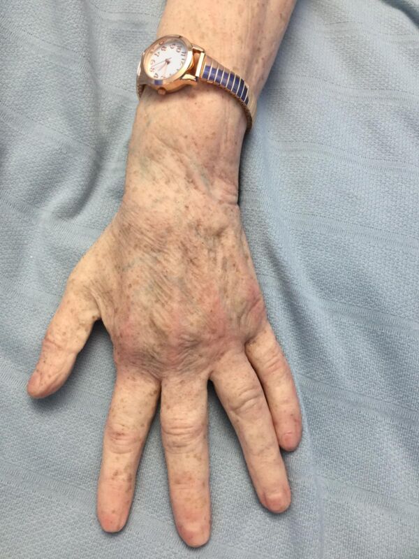Lifecast Body Simulation Senior Manikins - Echo Healthcare