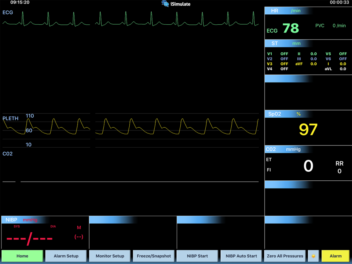 iSimulate - Echo Healthcare