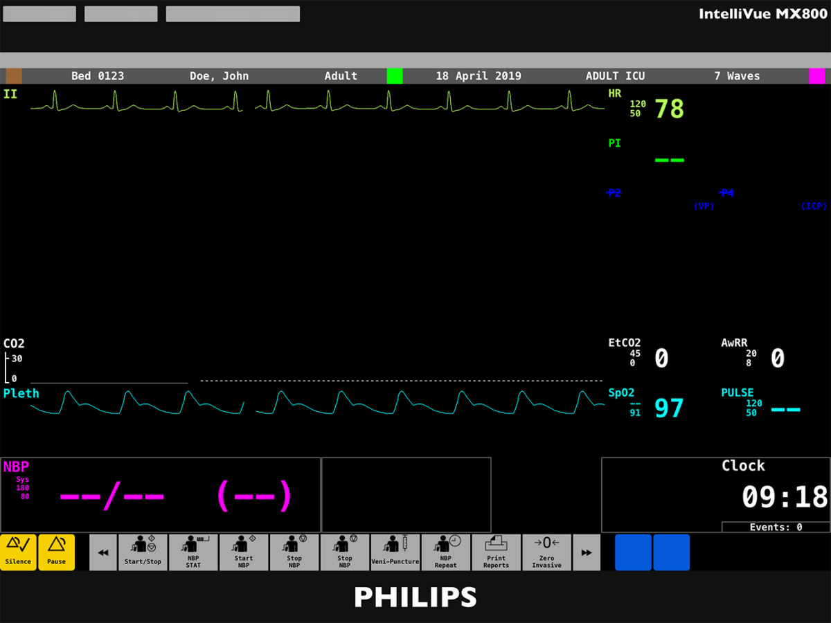 iSimulate - Echo Healthcare
