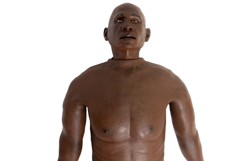 SecondSkin - Echo Healthcare